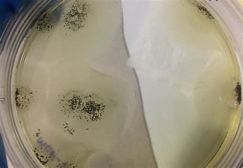 Contamination In Cell Culture Need Help R Labrats