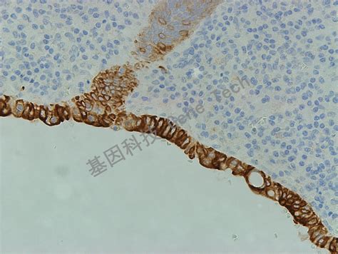 细胞角蛋白 19 抗体 鼠抗人 Ck19