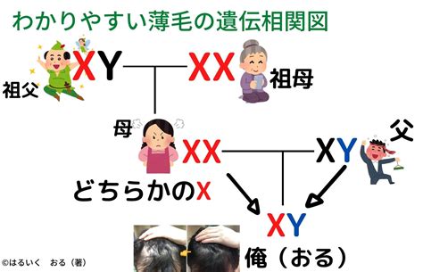 薄毛ハゲは遺伝と言うけど誰の遺伝？母親の父からx染色体を受け継ぐ はるいく