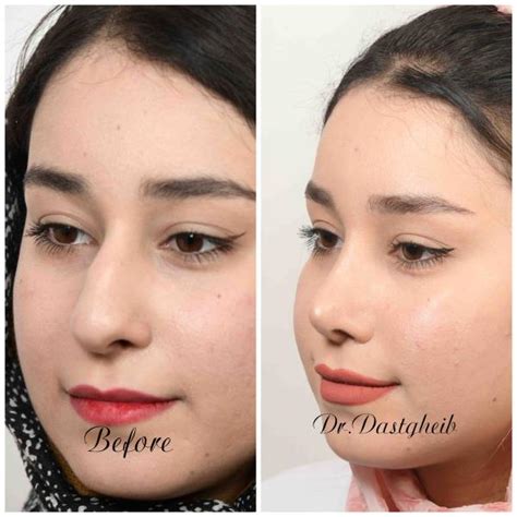 دکتر سید حسین دستغیب جراح بینی در شیراز متخصص گوش، حلق و بینی