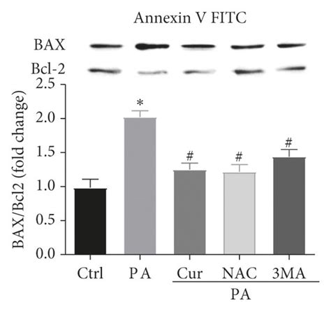 Oxidative Stress And Autophagy Is Involved In Curcumin Against
