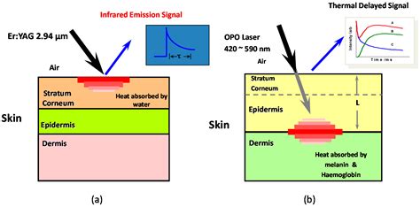 Photothermal Radiometry For Skin Research