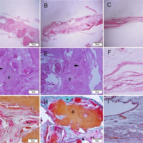 Photomicrographs Showing Hematoxylin And Eosin And Massons Trichrome