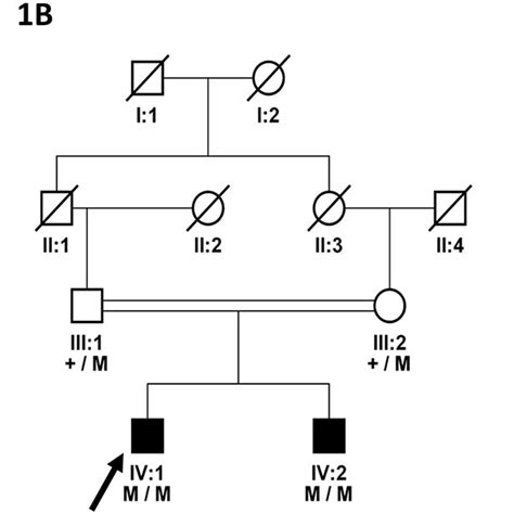 A Sanger Sequencing Chromatograms Showing III 1 Carrier And IV 1