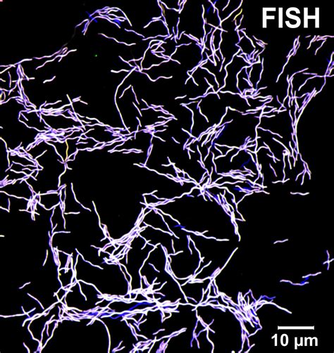 A Foul Smelling Savior How A New Gut Microbe Fights Dangerous Pathogens