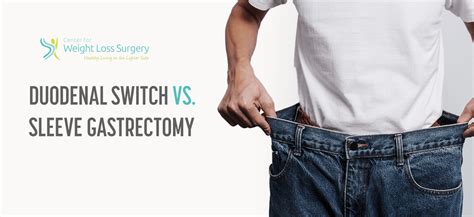 Duodenal Switch Vs Sleeve Gastrectomy