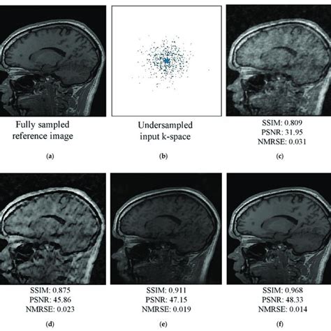 Mri Images From The Test Dataset Slice No 100 For Af 5 A Fully Download Scientific