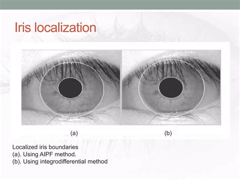 Iris Recognition System Pdf Eye And Vision Conditions Diseases And Conditions