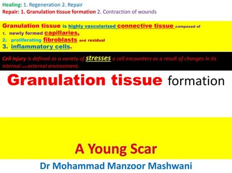 Morphology Of Acute Inflammation Ppt