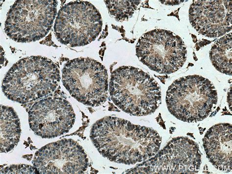 Pi16 Antibody 12267 1 Ap Proteintech