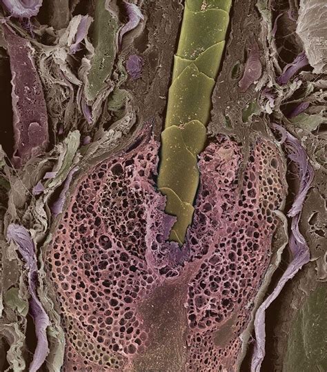 Hair Follicle Under Electron Microscope R Oddlysatisfying