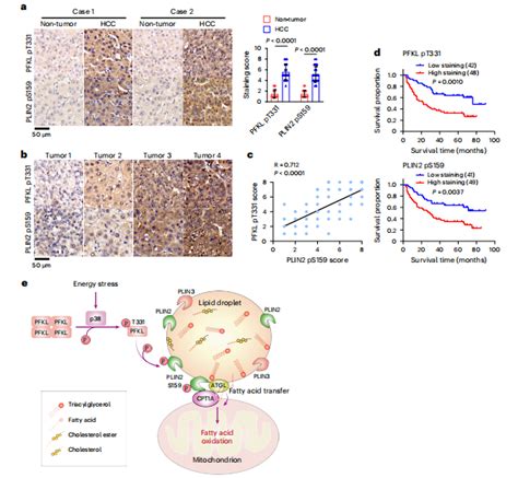 If 18 9！浙大医学院副院长吕志民、许大千教授团队揭示调控脂解与线粒体β 氧化的代谢枢纽 糖酵解酶pfkl的神奇作用 知乎