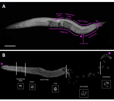 C Elegans Gonad Dissection And Freeze Crack For Immunofluorescence And