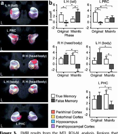 Figure 1 From Neural Activity During Encoding Predicts False Memories