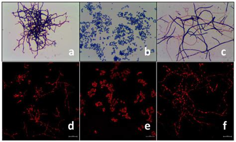 Polyhydroxyalkanoate Production By Actinobacterial Isolates In