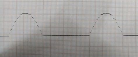 Stm32 Smooth Wave Plotting Using 3 Inch Thermal Printer Electrical