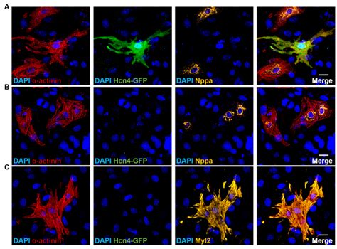 Assessing Cardiomyocyte Subtypes Following Transcription Factor Mediated Reprogramming Of Mouse
