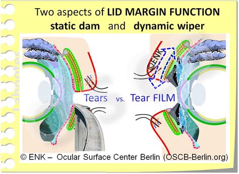 Glimpse On The Lid Margin — Ocular Surface Center Berlin