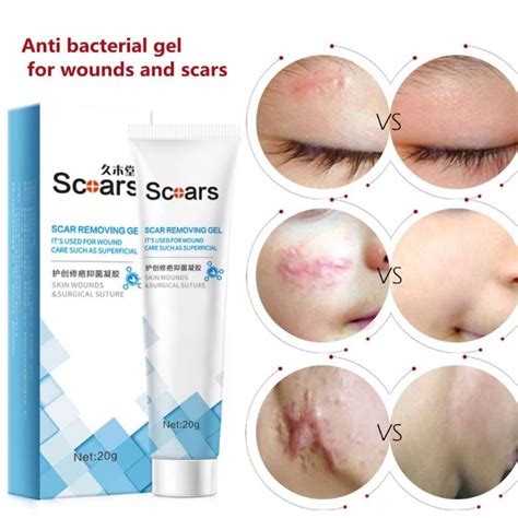 Scar Removal Cream Scar Repair Stretch Marks Burns Old Scars Scald