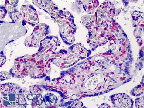Ihc Plus™ Ikbkg Nemo Ikk Gamma Monoclonal Antibody Mouse Lsbio