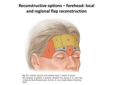 Scalp Reconstruction Pptx