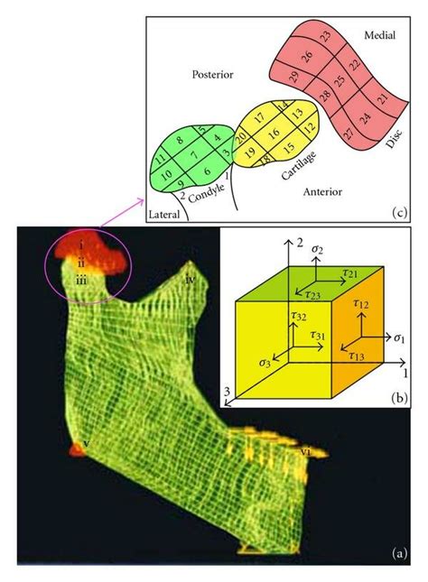 Finite Element Analysis Model Of Temporomandibular Joint Tmj Stress Download Scientific