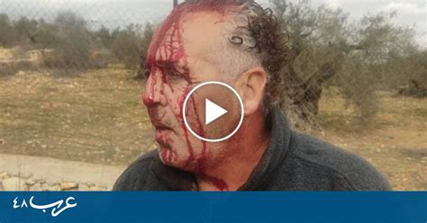 رام الله إصابة 3 فلسطينيين بجروح ورضوض إثر اعتداء إرهابي للمستوطنين