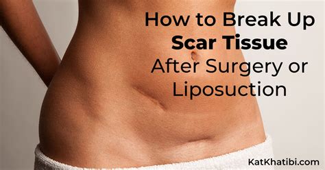 How To Break Up Scar Tissue After Surgery Or Liposuction Healthful
