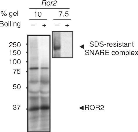Figure 1 From Combined Bimolecular Fluorescence Complementation Bifc And Förster Resonance