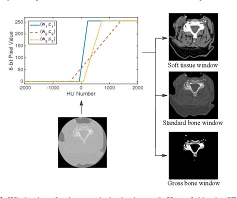 Table 1 From Deep Sequential Learning For Cervical Spine Fracture Detection On Computed