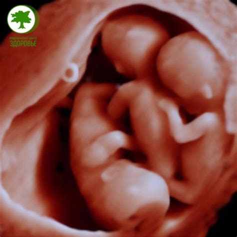 Клиника Здоровье Спокойствие будущей мамы УЗИ беременности экспертного класса ⠀ ️Каждой