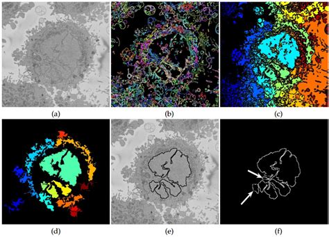 Segmentation Of 3D HeLa Cells File Exchange MATLAB Central