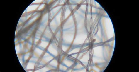 This Is Some Fluff Through A Microscope Imgur