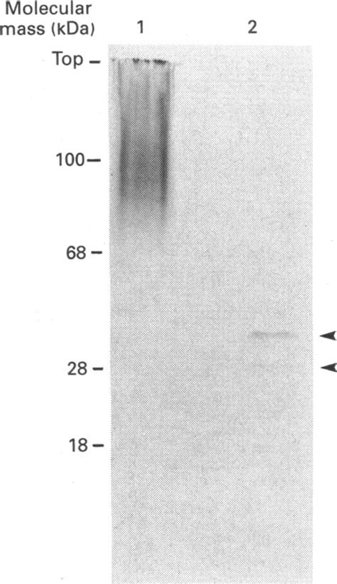 Fluorogram Of Proteoglycan And Proteoglycan Core Protein Analysed By