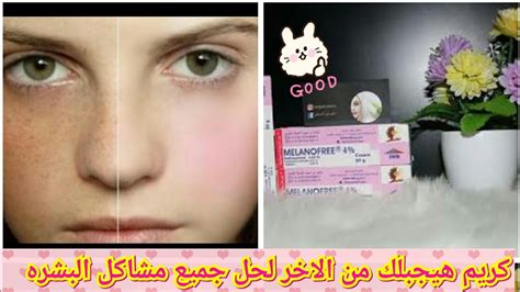 اقوي كريم تقشير لتفتيح البشره واثار الكلف و تفتيح الكوع والركب وازالة