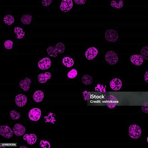 Sel Leukemik Berlabel Molekul Fluorescent Foto Stok Unduh Gambar