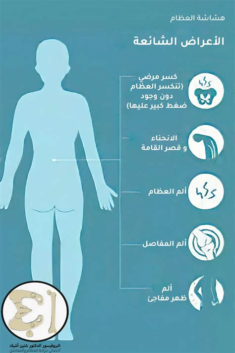 أحدث طرق علاج هشاشة العظام والوقاية منها د شتين اشيك