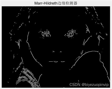 Matlab实现的图像分割之边缘检测和连接matlab边缘连接 Csdn博客