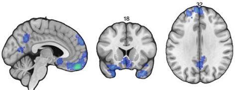 Results Of The Exploratory Network Coactivation Analysis Of The Download Scientific Diagram