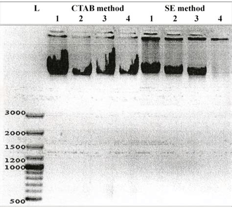 Agarose Gel Electrophoresis Of Total Genomic Dna Samples Isolated From