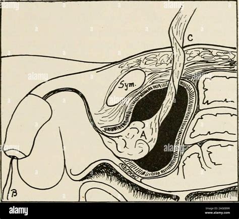 Local And Regional Anesthesia With Chapters On Spinal Epidural Paravertebral And