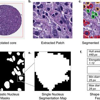 Tissue Microarrays TMAs With Region Of Interest ROI Annotations