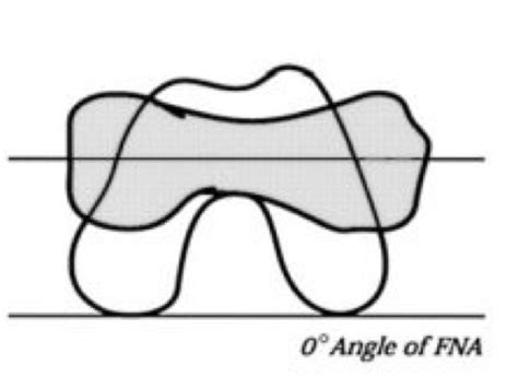 Boney Alignment Flashcards Quizlet