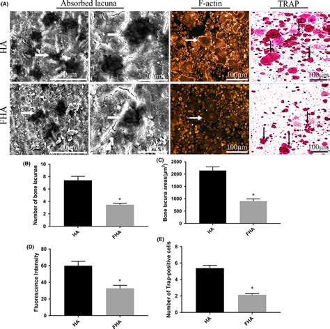 Fha Inhibited Osteoclasts Formation And Function A Representative