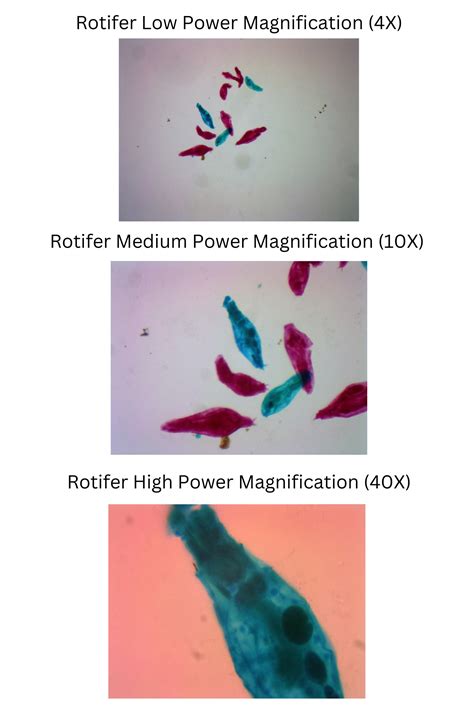 Solved Attached Is A Rotifer Slide Under The Microscope At