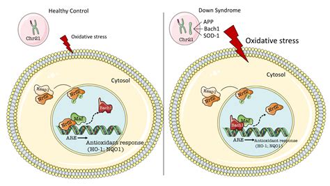 Antioxidants Free Full Text The Bach1nrf2 Axis In Brain In Down