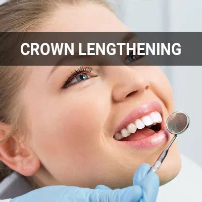 Crowns Vs Implants Cypress TX Charles E Dyer IV DDS MS PC
