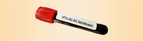 Liver Function Test Redcliffe Community