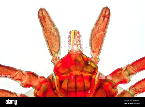 Tick Light Micrograph Of The Head Of A Male Castor Bean Tick Ixodes Ricinus Showing Its