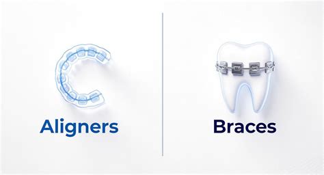 Clear Aligners Vs Braces Which Smile Solution Fits You